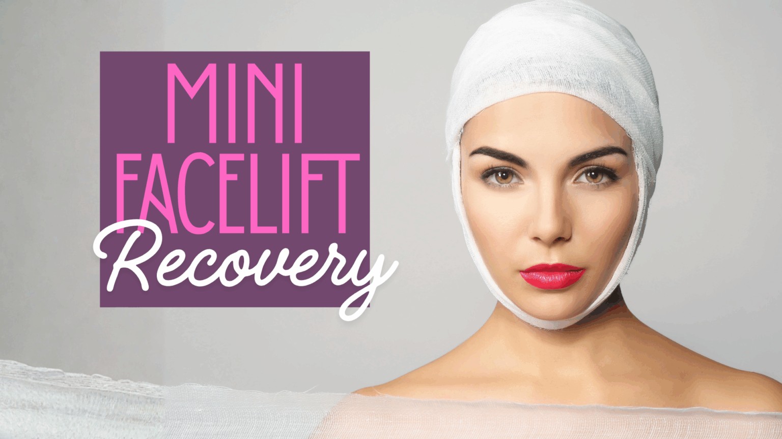 Mini Facelift Recovery - Konstantin Vasyukevich, MD